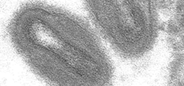 Global Outbreak Update: Laboratory-confirmed case of monkeypox in the UK